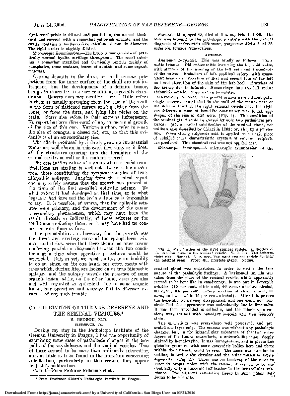 (PDF) Calcification of the Vas Deferens and the Seminal Vesicles