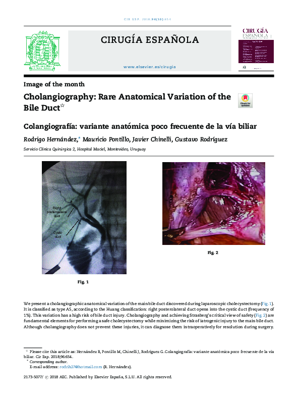 (PDF) Cholangiography: Rare anatomical variation of the bile duct