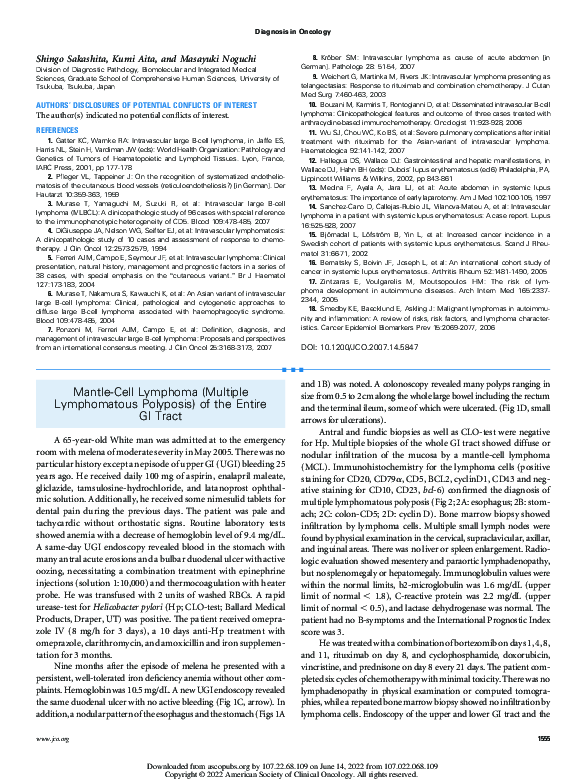 (PDF) Mantle-Cell Lymphoma (Multiple Lymphomatous Polyposis) of the ...