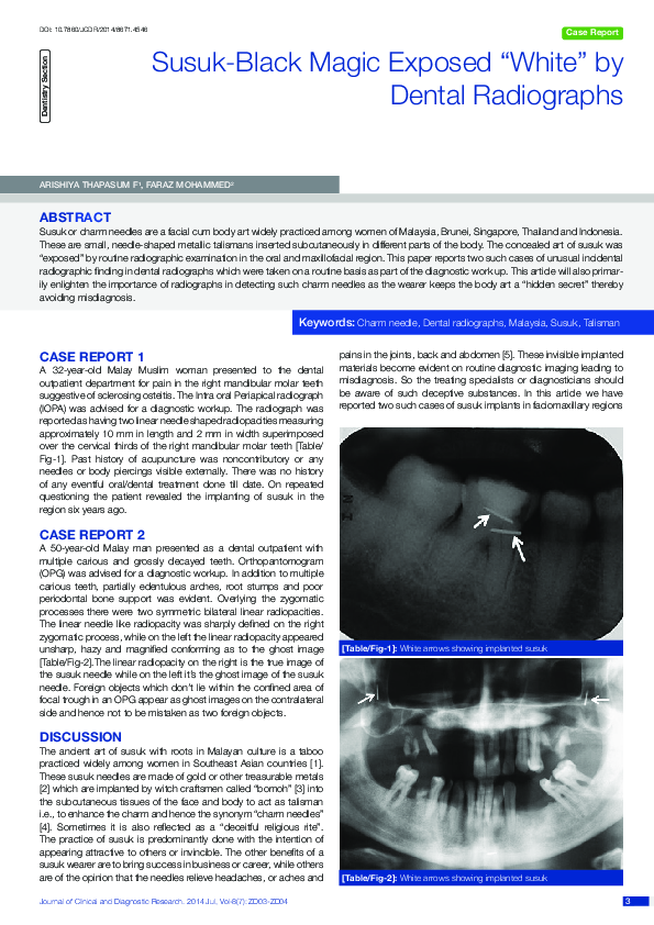 (PDF) Susuk - black magic exposed "white" by dental radiographs | Dr ...