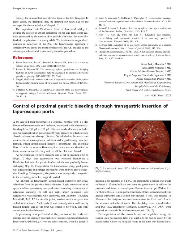 (PDF) Control of proximal gastric bleeding through transgastric ...