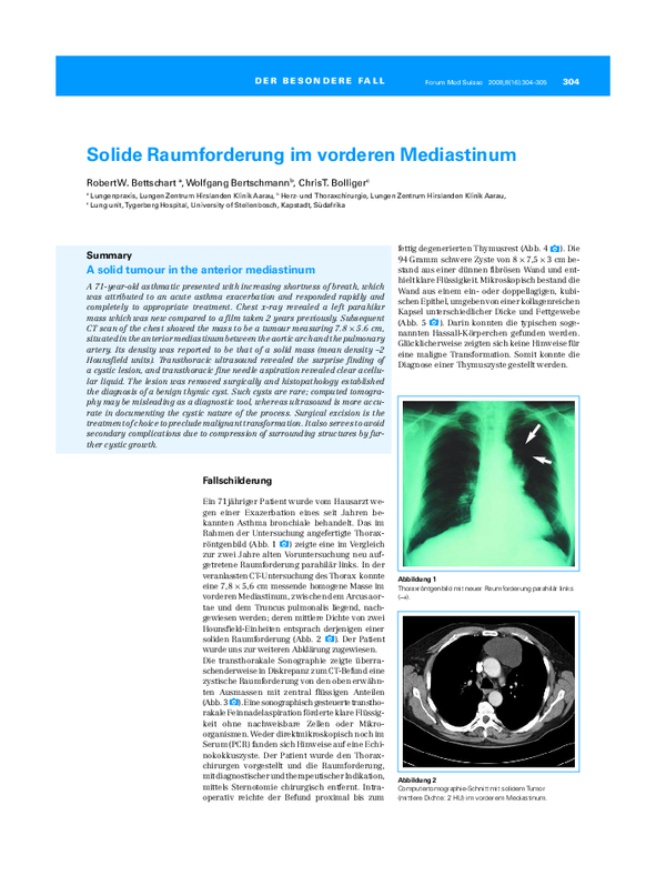 (PDF) Solide Raumforderung im vorderen Mediastinum | Robert Bettschart ...