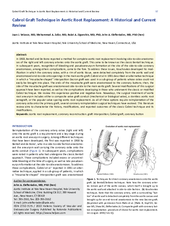 (PDF) Cabrol Graft Technique in Aortic Root Replacement: A Historical ...