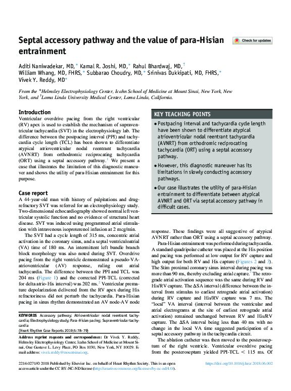 (PDF) Septal Accessory Pathway and the Value of Para-Hisian Entrainment