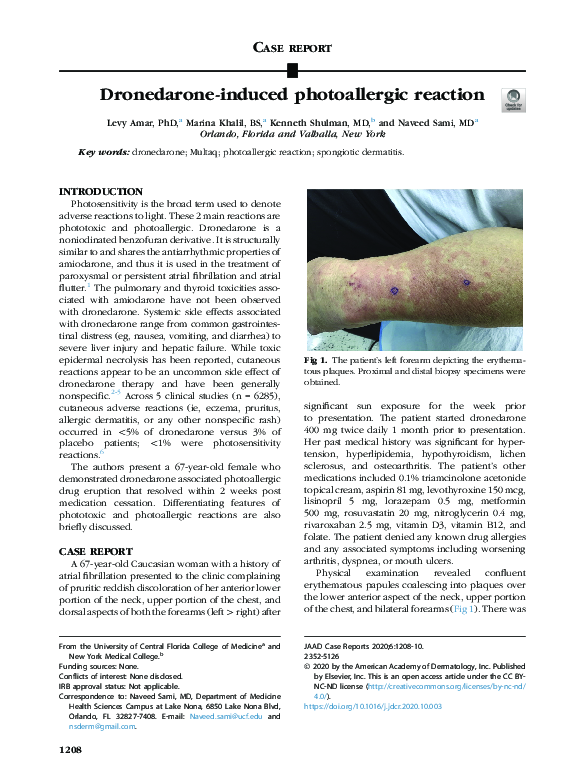 (PDF) Dronedarone-induced photoallergic reaction