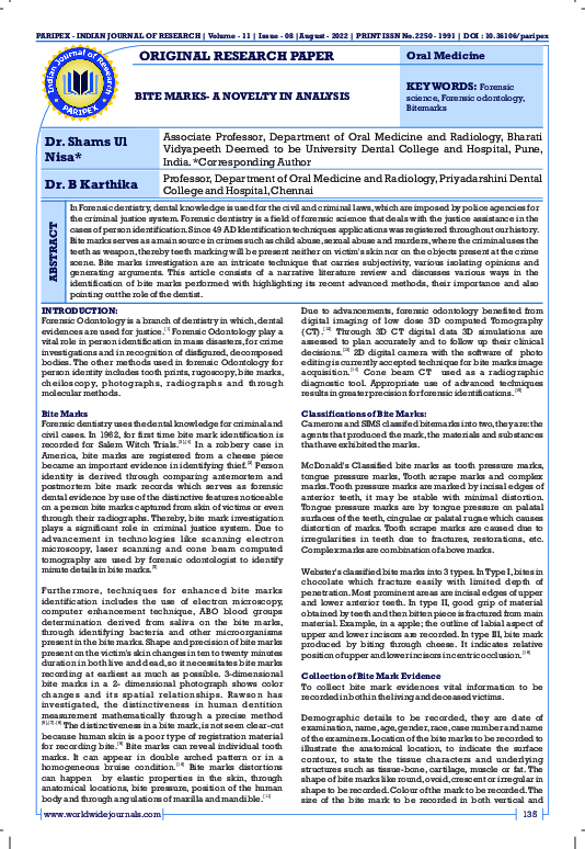 (PDF) Bite Marks- a Novelty in Analysis