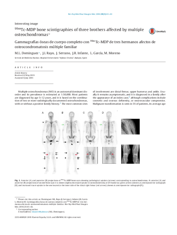(PDF) 99m Tc-MDP bone scintigraphies of three brothers affected by ...