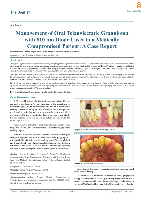 (PDF) Management of Oral Telangiectatic Granuloma with 810 nm Diode ...