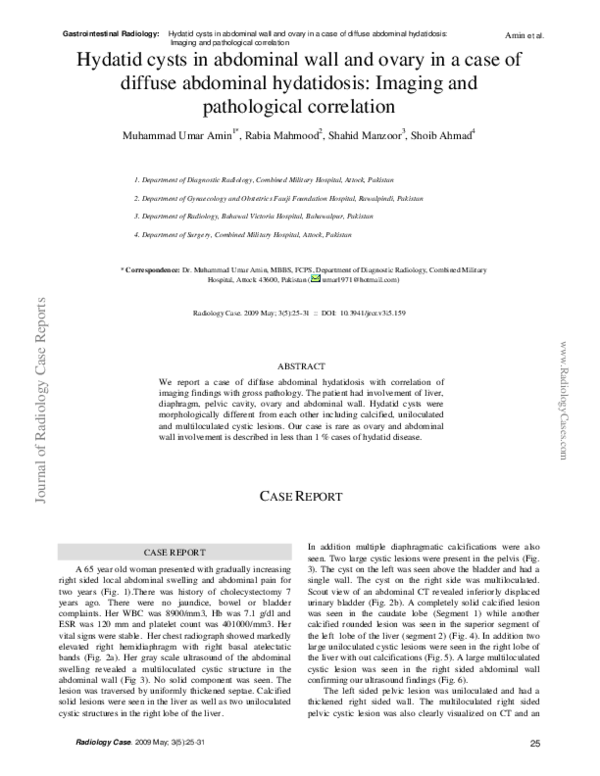 (PDF) Hydatid cysts in abdominal wall and ovary in a case of diffuse ...