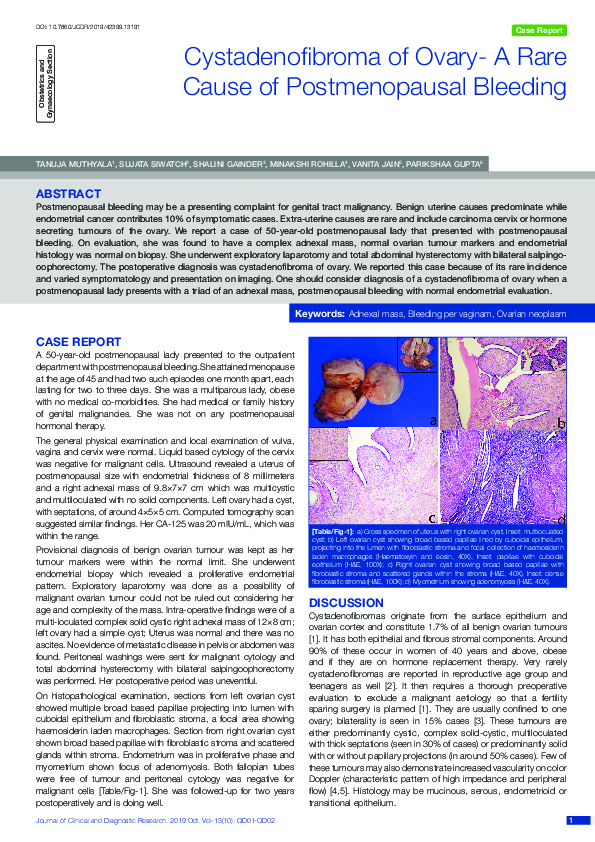 (PDF) Cystadenofibroma of Ovary- A Rare Cause of Postmenopausal Bleeding