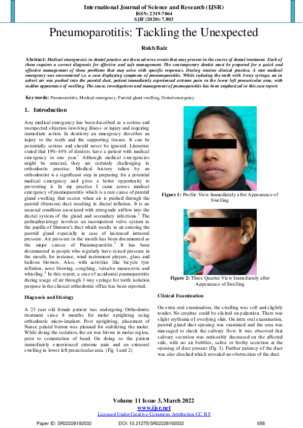 (PDF) Pneumoparotitis: Tackling the Unexpected