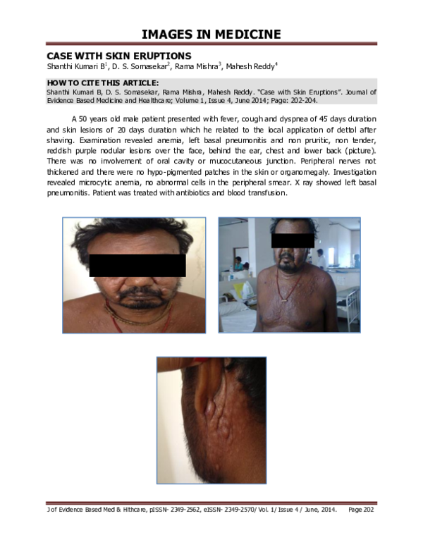 (PDF) Case with Skin Eruptions