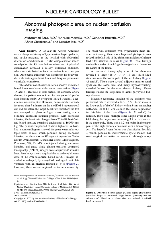 (PDF) Abnormal photopenic area on nuclear perfusion imaging | Muhammad ...