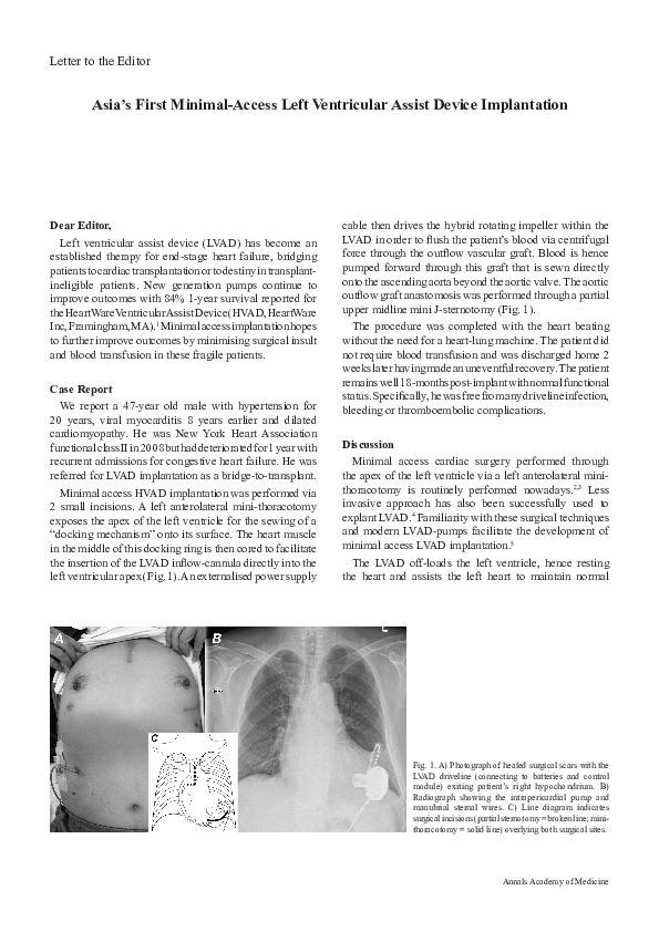 (PDF) Asia’s First Minimal-Access Left Ventricular Assist Device ...