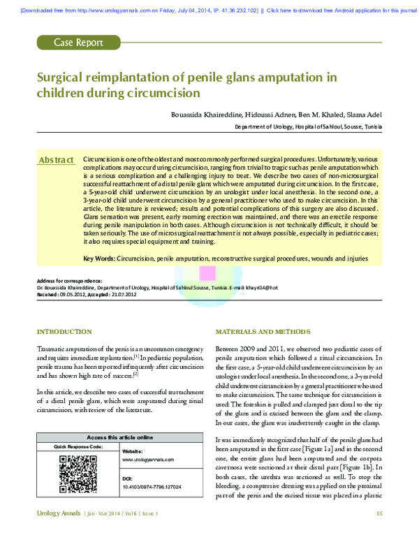(PDF) Surgical reimplantation of penile glans amputation in children ...