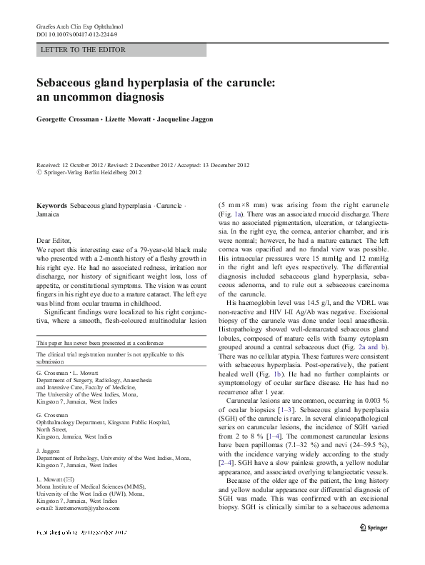 (PDF) Sebaceous gland hyperplasia of the caruncle: an uncommon diagnosis
