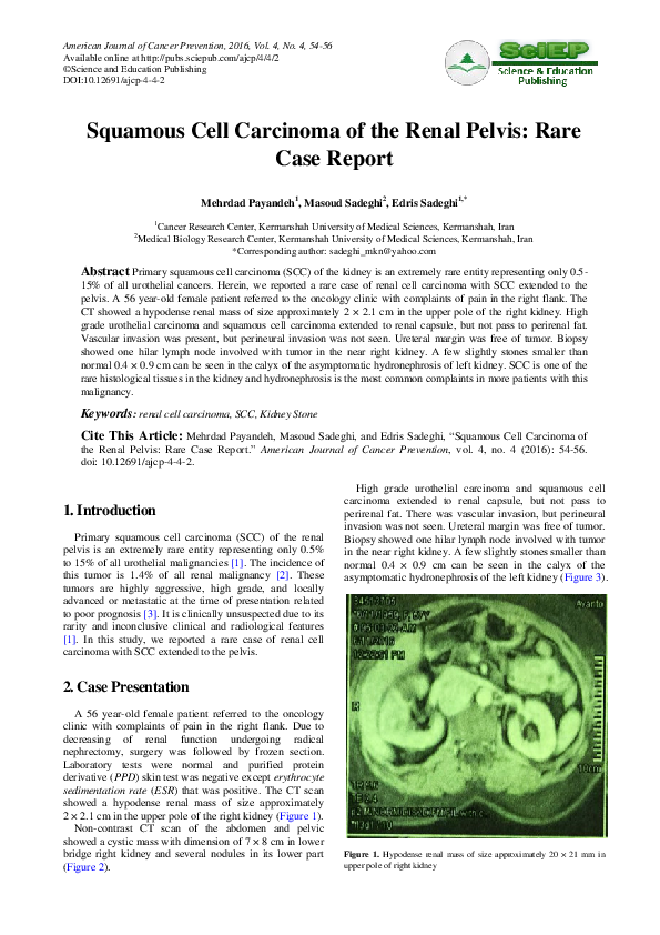Pdf Squamous Cell Carcinoma Of The Renal Pelvis Rare Case Report