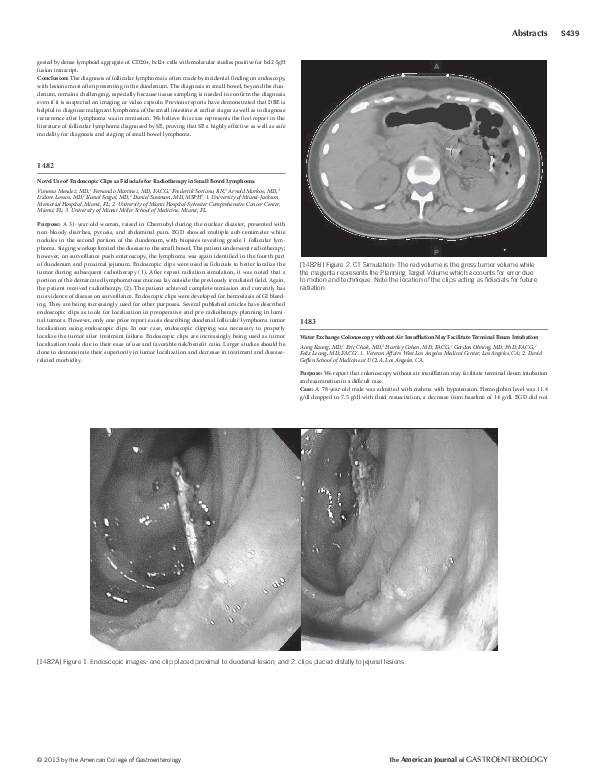 (PDF) Water Exchange Colonoscopy without Air Insufflation May ...