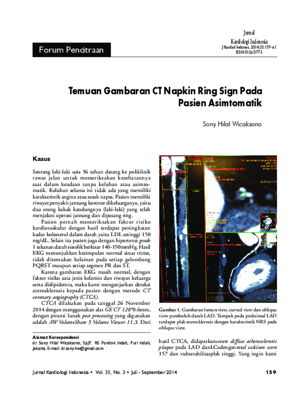 (PDF) Temuan Gambaran CT Napkin Ring Sign Pada Pasien Asimtomatik