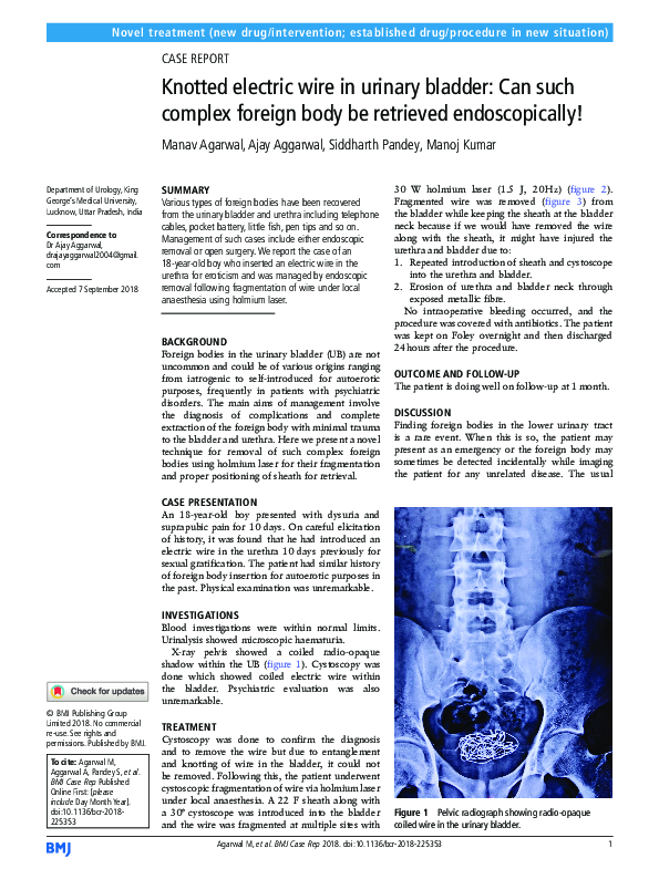 (PDF) Knotted electric wire in urinary bladder: Can such complex ...
