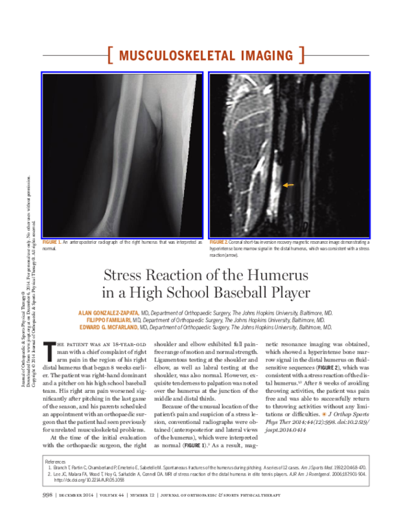 (PDF) Stress Reaction of the Humerus in a High School Baseball Player