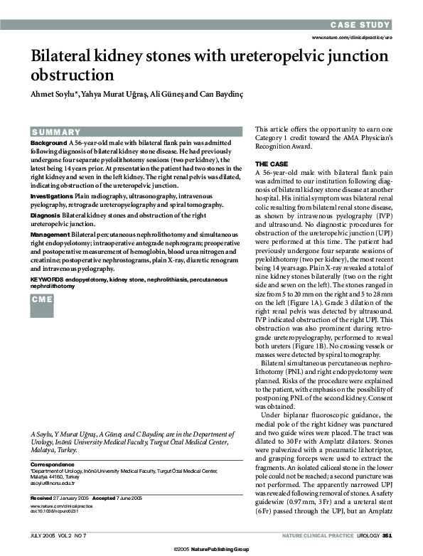 (PDF) Bilateral kidney stones with ureteropelvic junction obstruction