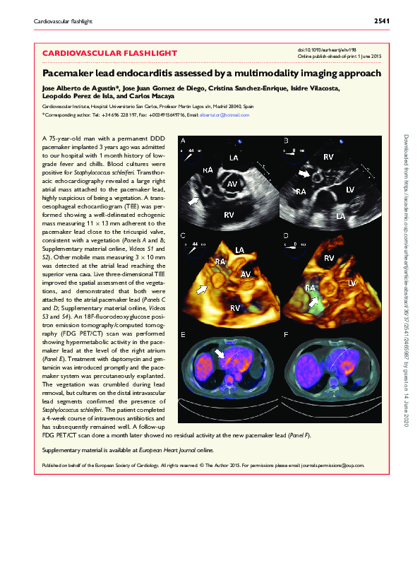 (PDF) Pacemaker lead endocarditis assessed by a multimodality imaging ...