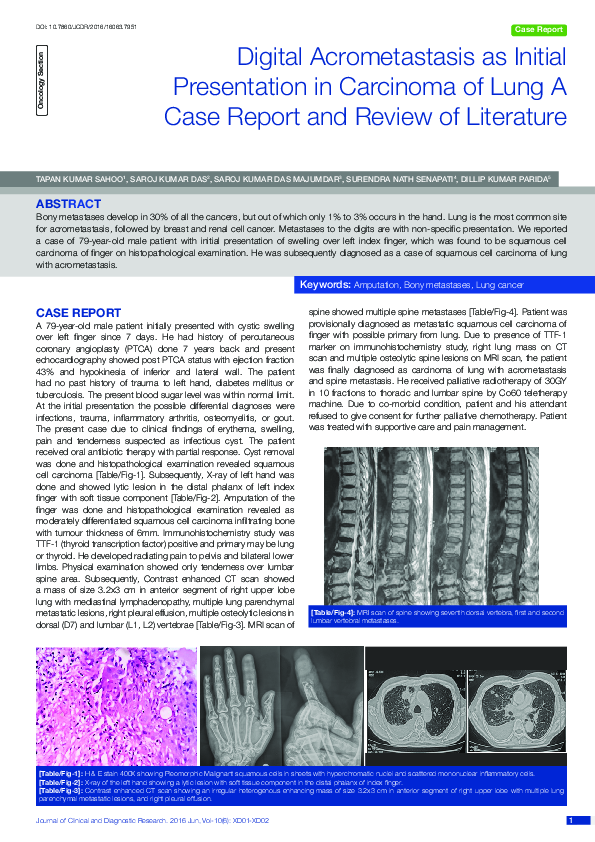 (PDF) Digital Acrometastasis as Initial Presentation in Carcinoma of ...