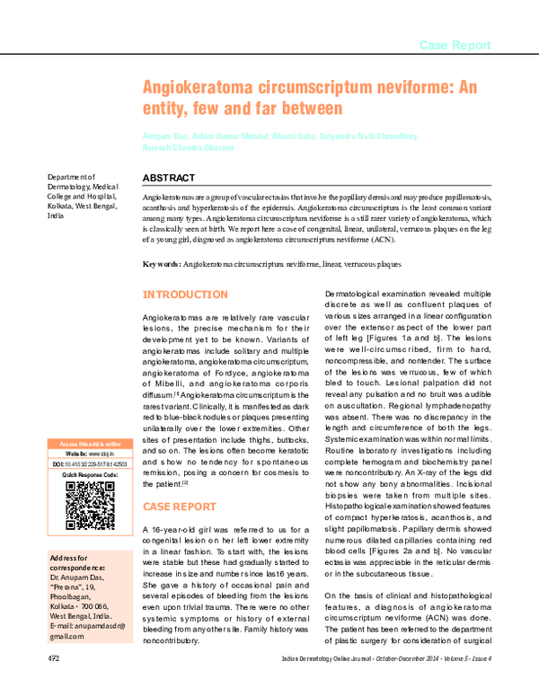 (PDF) Angiokeratoma circumscriptum neviforme: An entity, few and far ...