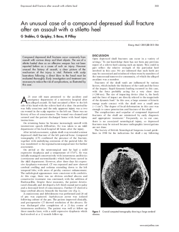 (PDF) An unusual case of a compound depressed skull fracture after an ...