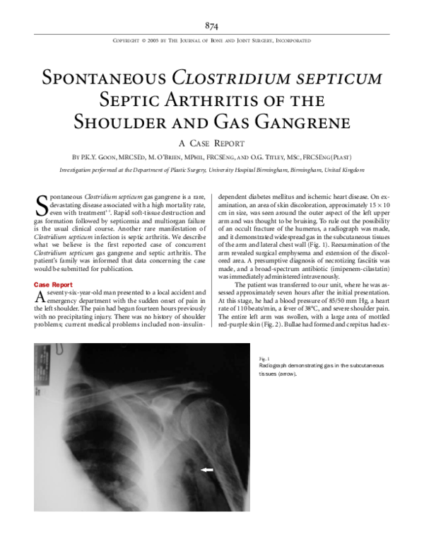 (PDF) Spontaneous Clostridium septicum Septic Arthritis of the Shoulder ...