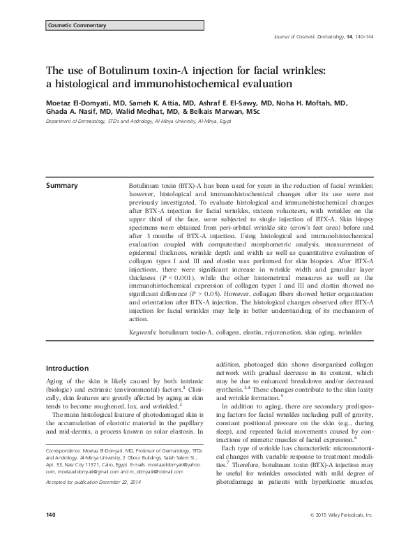 (PDF) The use of Botulinum toxin-A injection for facial wrinkles: a ...