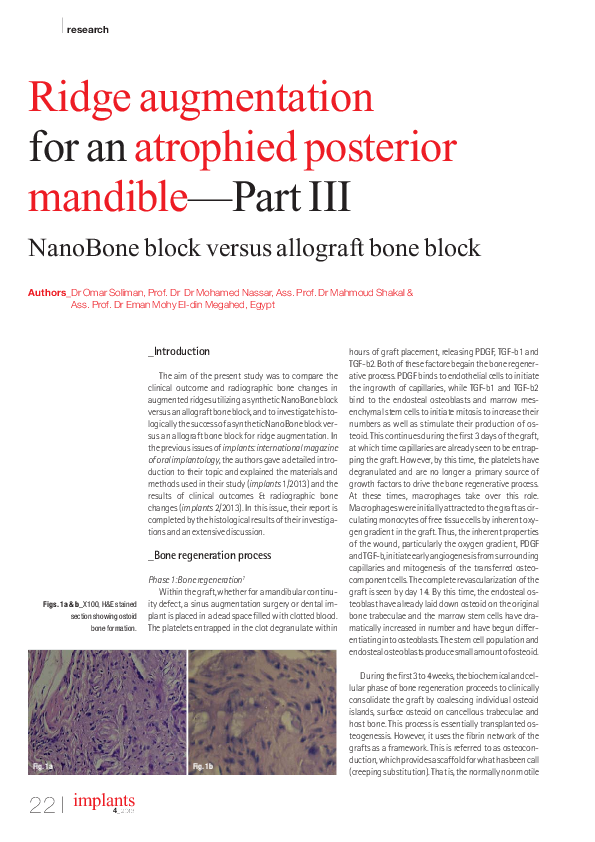 (PDF) Ridge augmentation for an atrophied posterior mandible — Part III ...