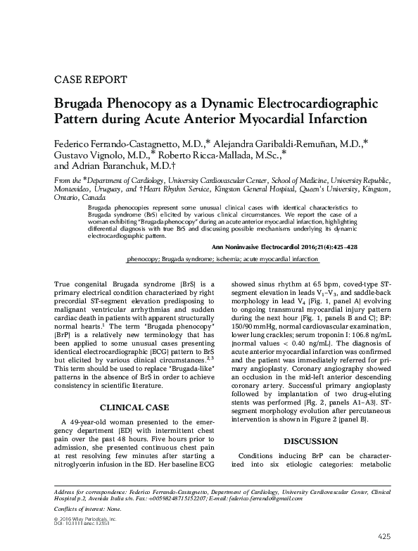 (PDF) Brugada Phenocopy as a Dynamic ECG Pattern during Acute Anterior ...