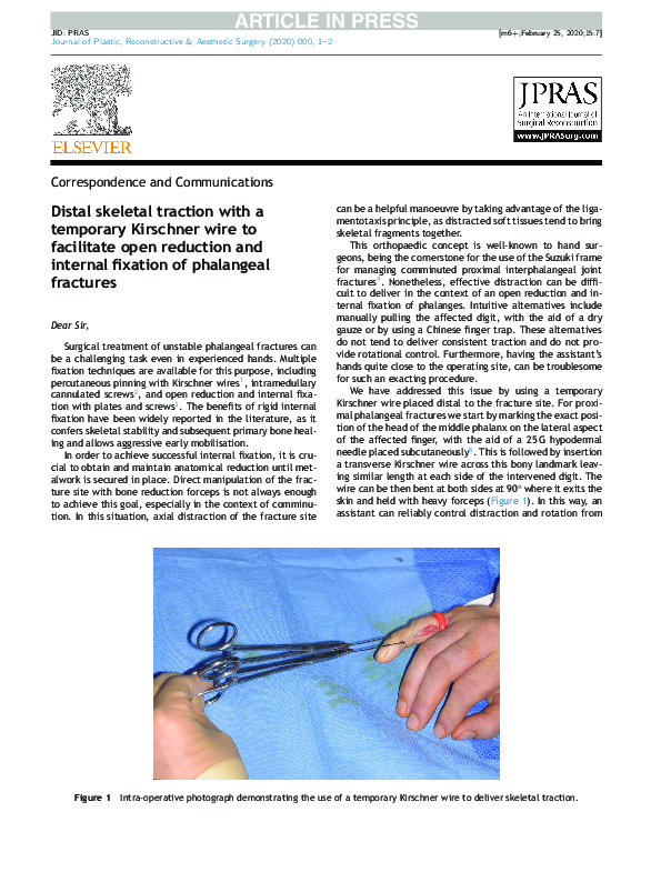 (PDF) Distal skeletal traction with a temporary Kirschner wire to ...
