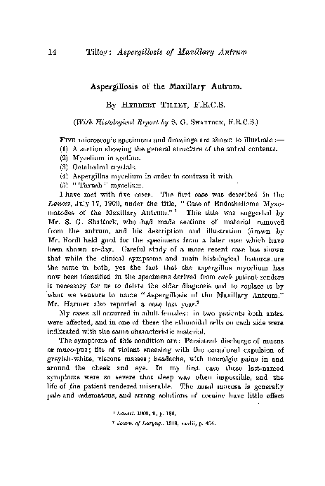 (PDF) Aspergillosis of the Maxillary Antrum | Steven Roser - Academia.edu