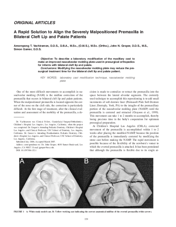 (PDF) A Rapid Solution to Align the Severely Malpositioned Premaxilla in Bilateral Cleft Lip and ...