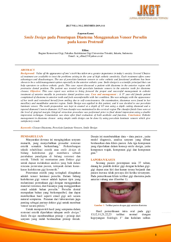 (PDF) Smile Design pada Penutupan Diastema Menggunakan Veneer Porselin ...