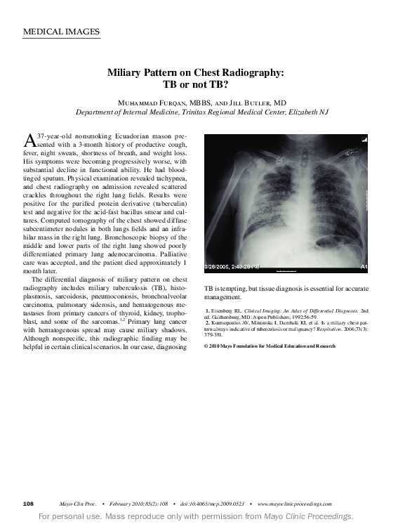 (PDF) Miliary Pattern: TB vs Lung Adenocarcinoma