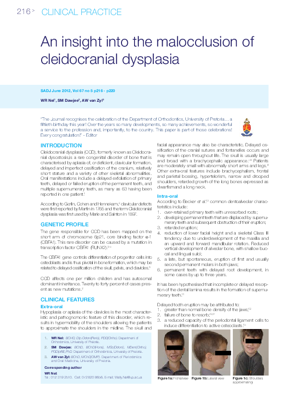 (PDF) An insight into the malocclusion of cleidocranial dysplasia
