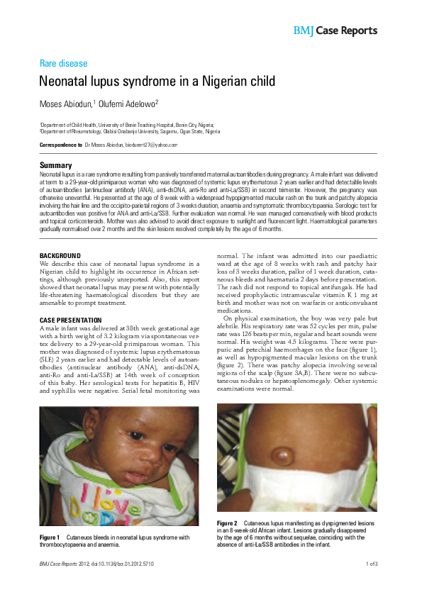 (PDF) Neonatal lupus syndrome in a Nigerian child | Femi Adelowo ...
