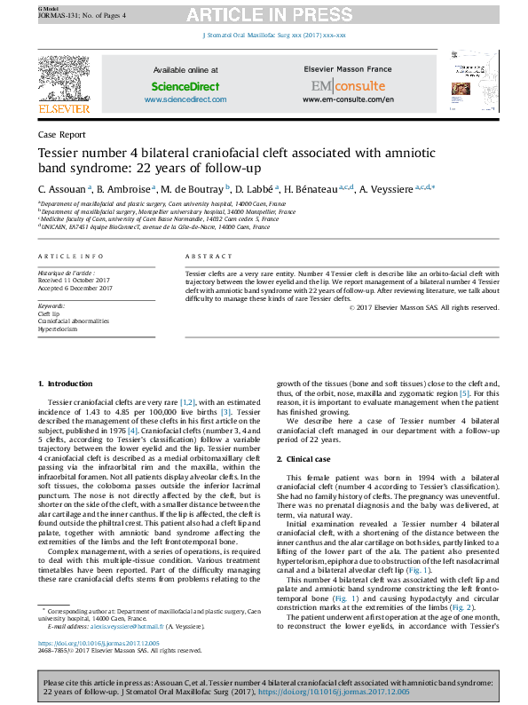 (PDF) Tessier number 4 bilateral craniofacial cleft associated with ...