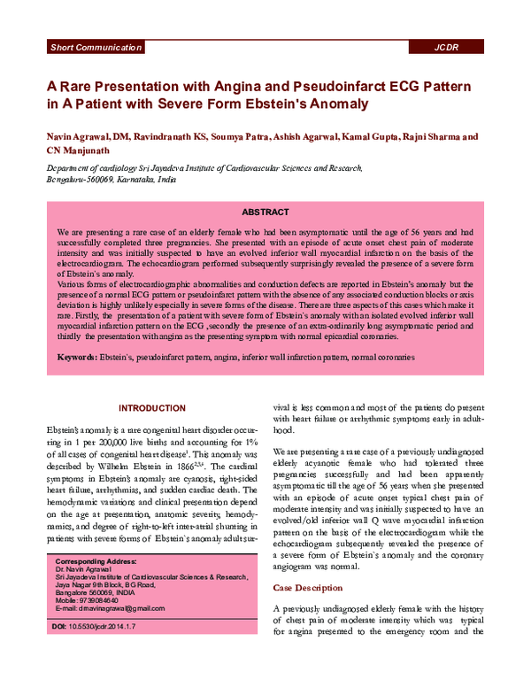 A Rare Presentation with Angina and Pseudoinfarct ECG Pattern in A ...