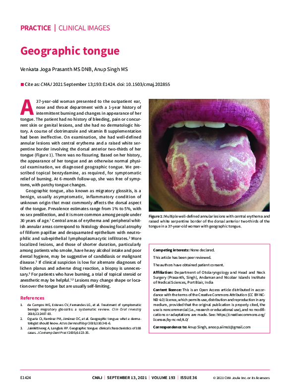 (PDF) Geographic tongue
