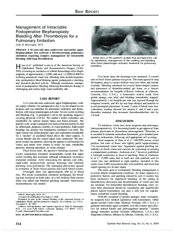 (PDF) Rituximab Immunotherapy for Ocular Adnexal Lymphoma ...