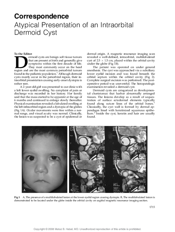 Pdf Atypical Presentation Of An Intraorbital Dermoid Cyst Tolga