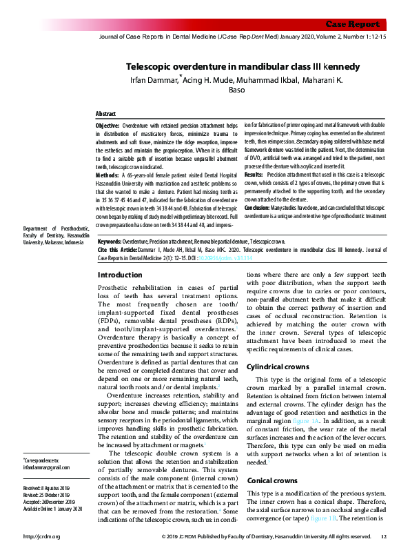 (PDF) Telescopic overdenture in mandibular class III kennedy