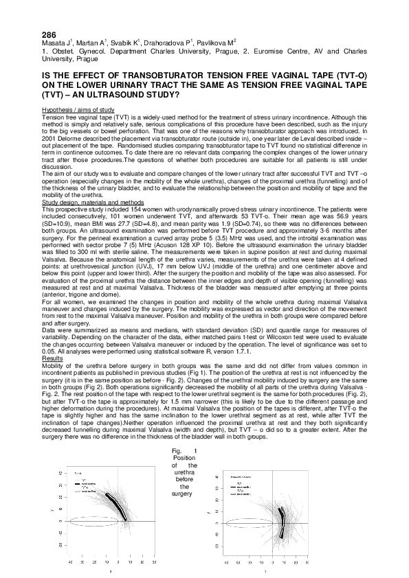 (PDF) Is the effect of transobturator tension free vaginal tape (TVT-o ...