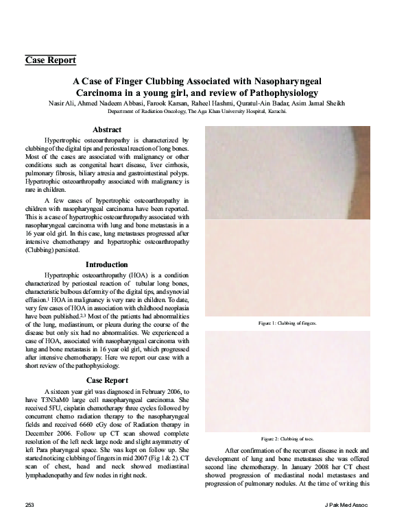 (PDF) A case of finger clubbing associated with nasopharyngeal ...