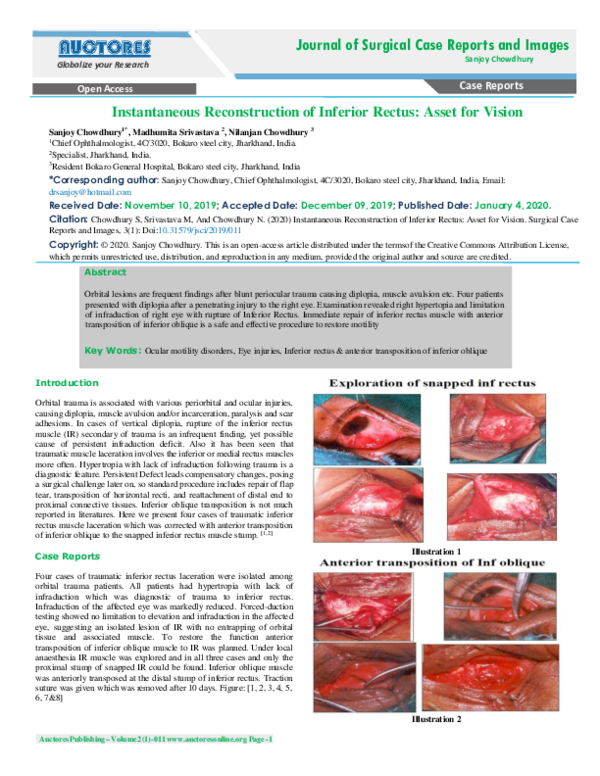 (PDF) Instantaneous Reconstruction of Inferior Rectus: Asset for Vision
